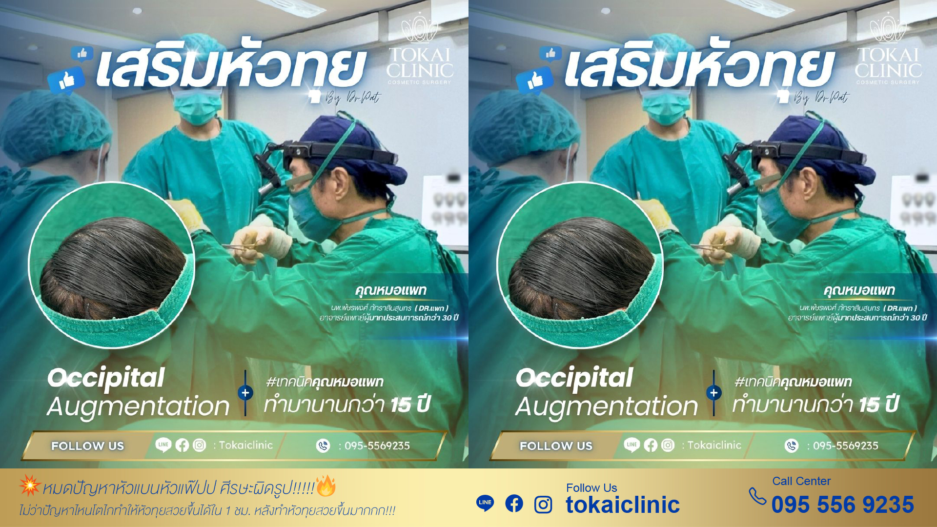 Occipital Back Of Head Augmentation Surgery. No matter what the problem ...